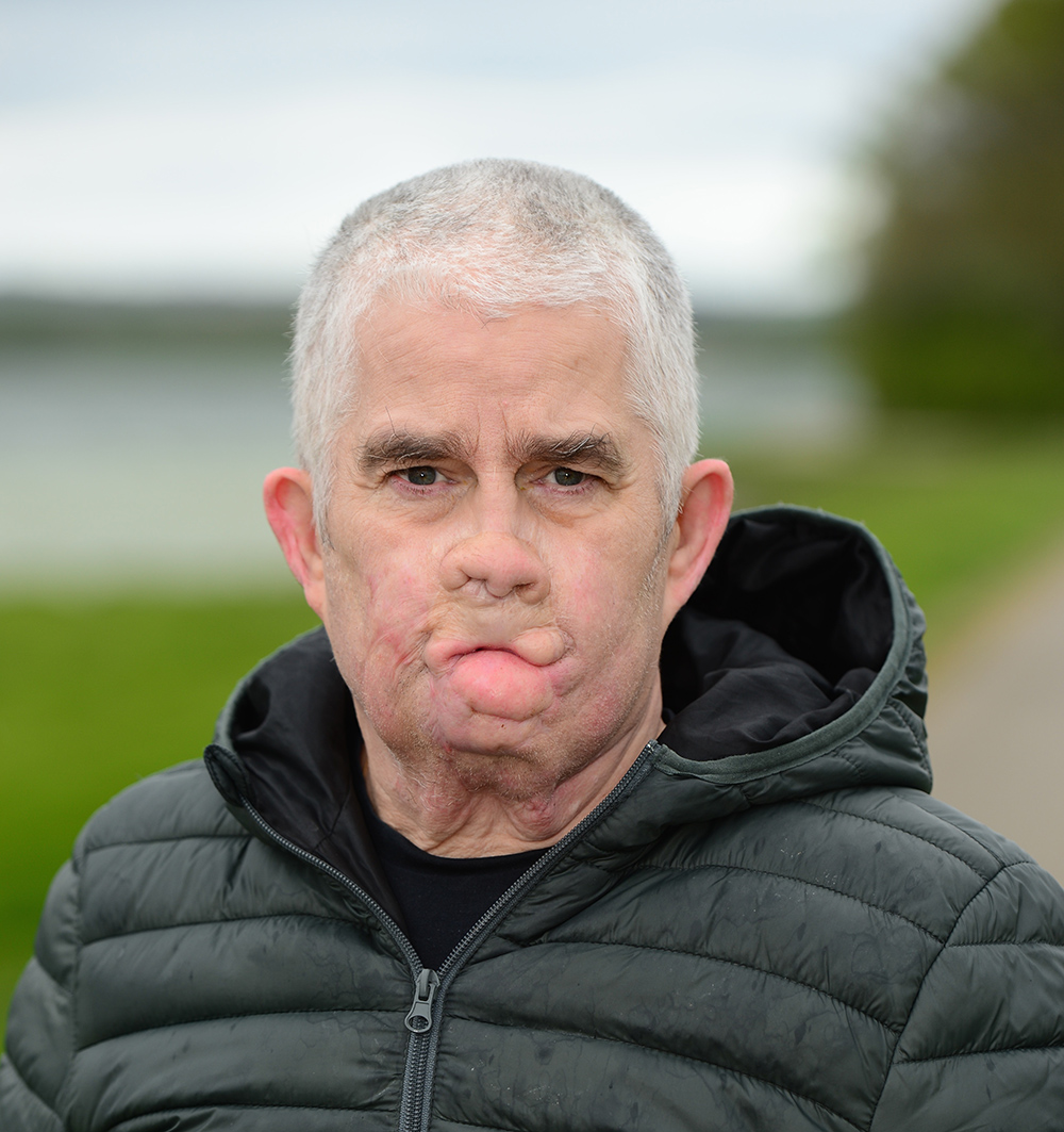 Search Results | Royal College of Nursing