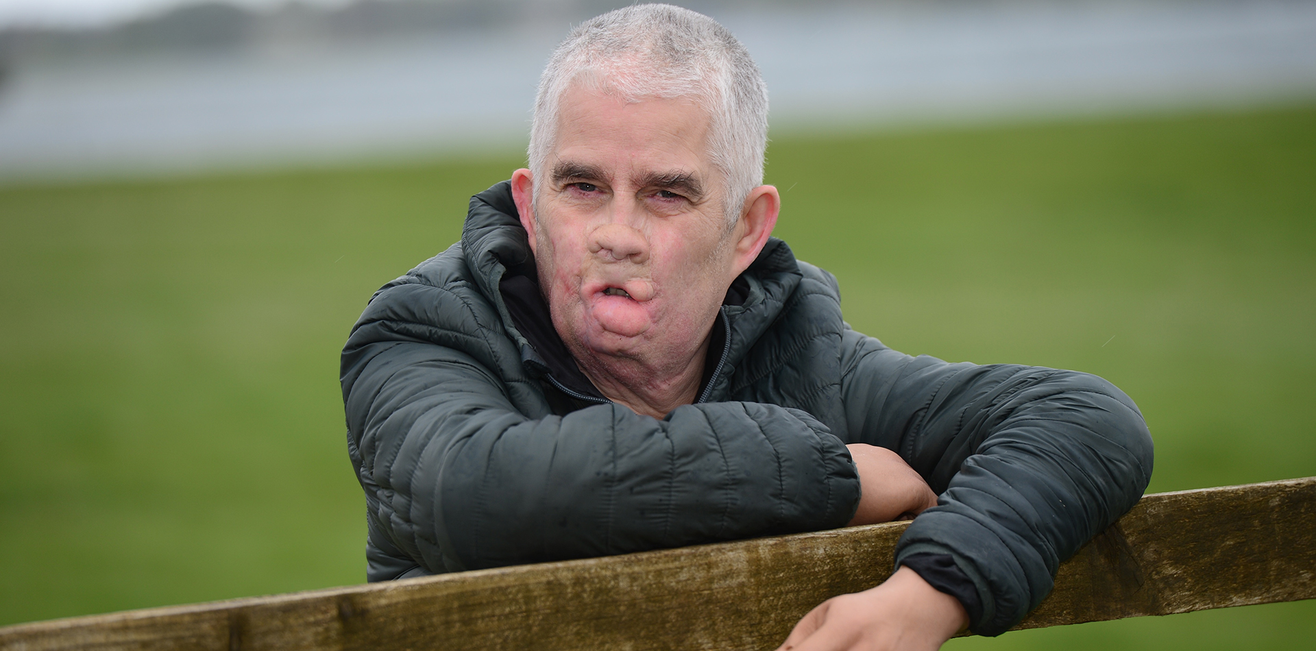 Life beyond sepsis | Bulletin | Royal College of Nursing