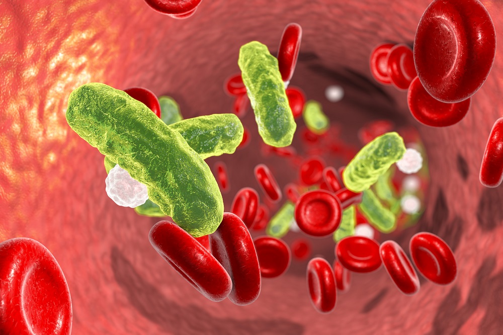 Always think sepsis | RCN Students | Royal College of Nursing